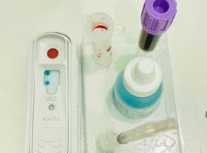 Saiba tudo sobre o teste 4Dx: protegendo seu cão das principais doenças ...